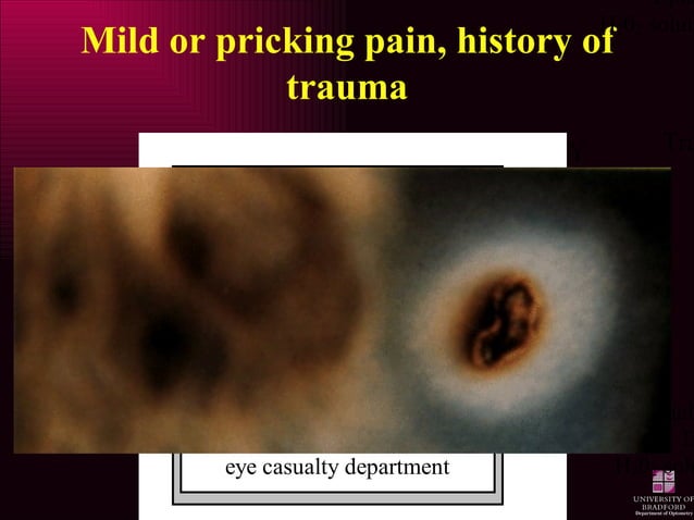 Differential Diagnosis of Red Eye