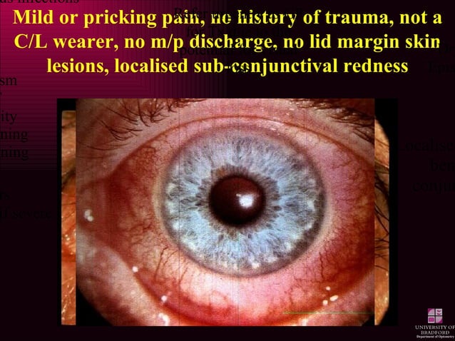 Differential Diagnosis of Red Eye