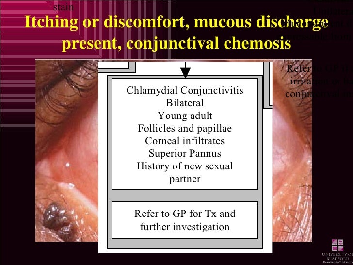 Differential Diagnosis of Red Eye