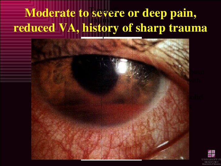 Differential Diagnosis of Red Eye