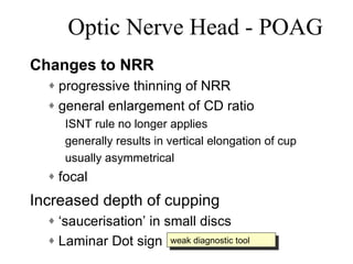 Glaucoma | PPT
