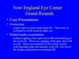 Hypotony Maculopathy | PPT