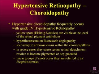 Hypertensive Retinopathy | PPT