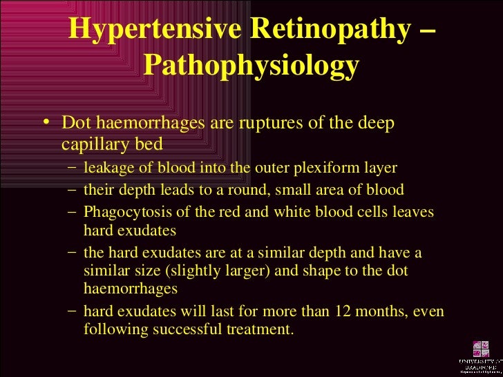 Hypertensive Retinopathy