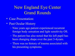 Iridocorneal endothelial (ICE) syndrome | PPT