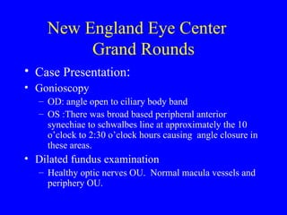 Iridocorneal endothelial (ICE) syndrome | PPT