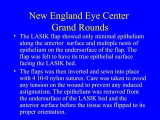 Lasik flap problem | PPT