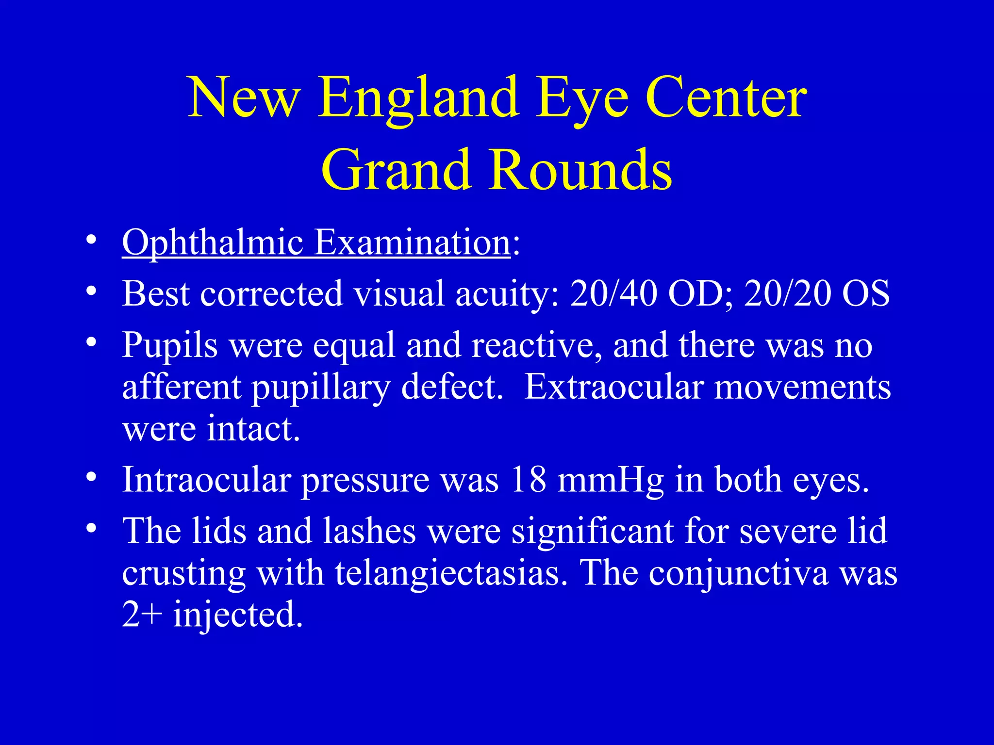 peripheral ulcerative keratopathy | PPT