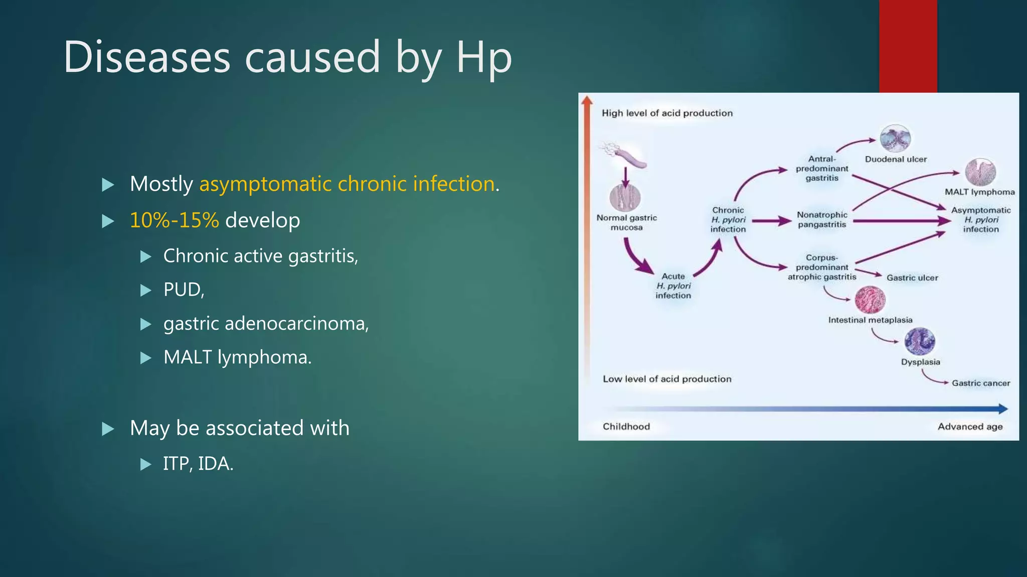Helicobacter pylori associated Peptic ulcer disease | PPT
