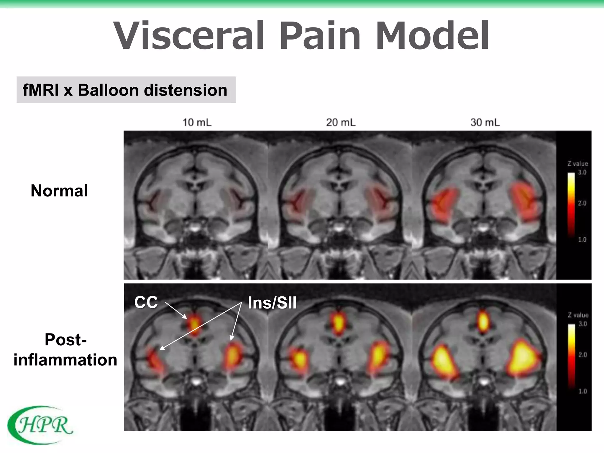 Functional Brain Imaging of Pain | PPTX