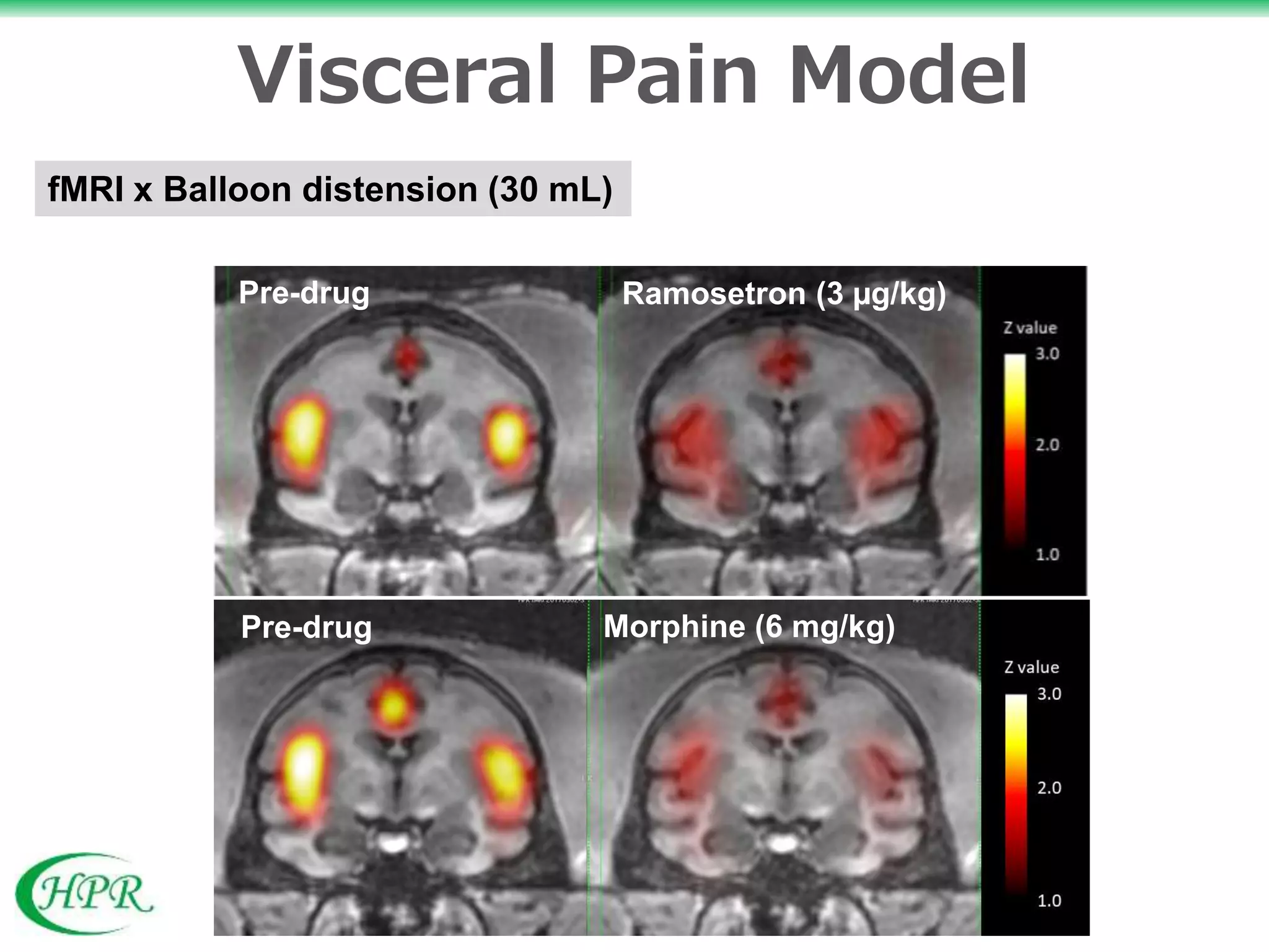 Functional Brain Imaging of Pain | PPTX