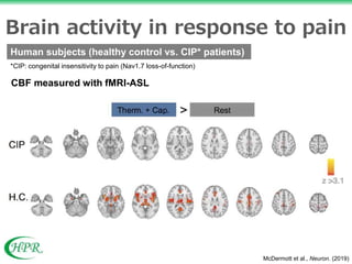 Functional Brain Imaging of Pain | PPTX