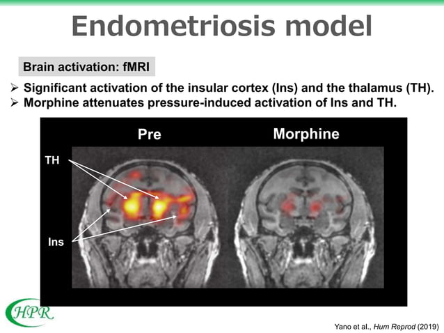 Functional Brain Imaging of Pain | PPT