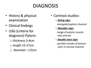 Hypertrophic Pyloric Stenosis | PPTX