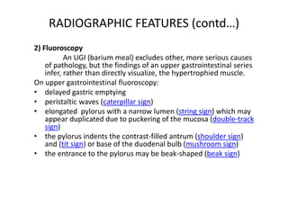 Hypertrophic Pyloric Stenosis | PPTX