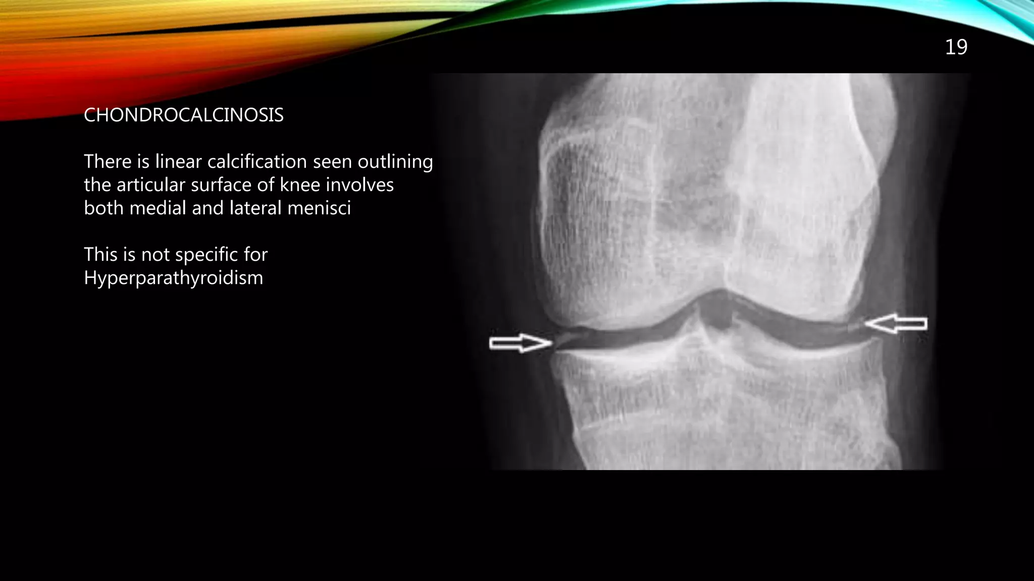 IMAGING IN HYPERPARATHYROIDISM | PPTX