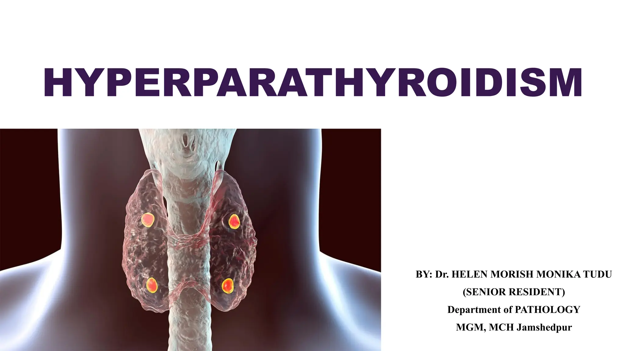 HYPERPARATHYROIDISM : ETIOLOGY, PATHOGENESIS & DIAGNOSIS. | PPTX