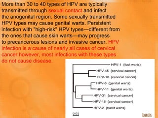 Hpv - Human Papilloma Virus | PPTX