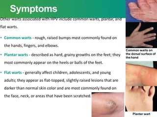 Human Papilloma Virus | PPTX