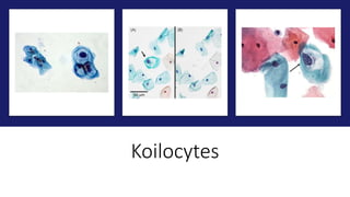 Human Papilloma Virus(HPV).pptx