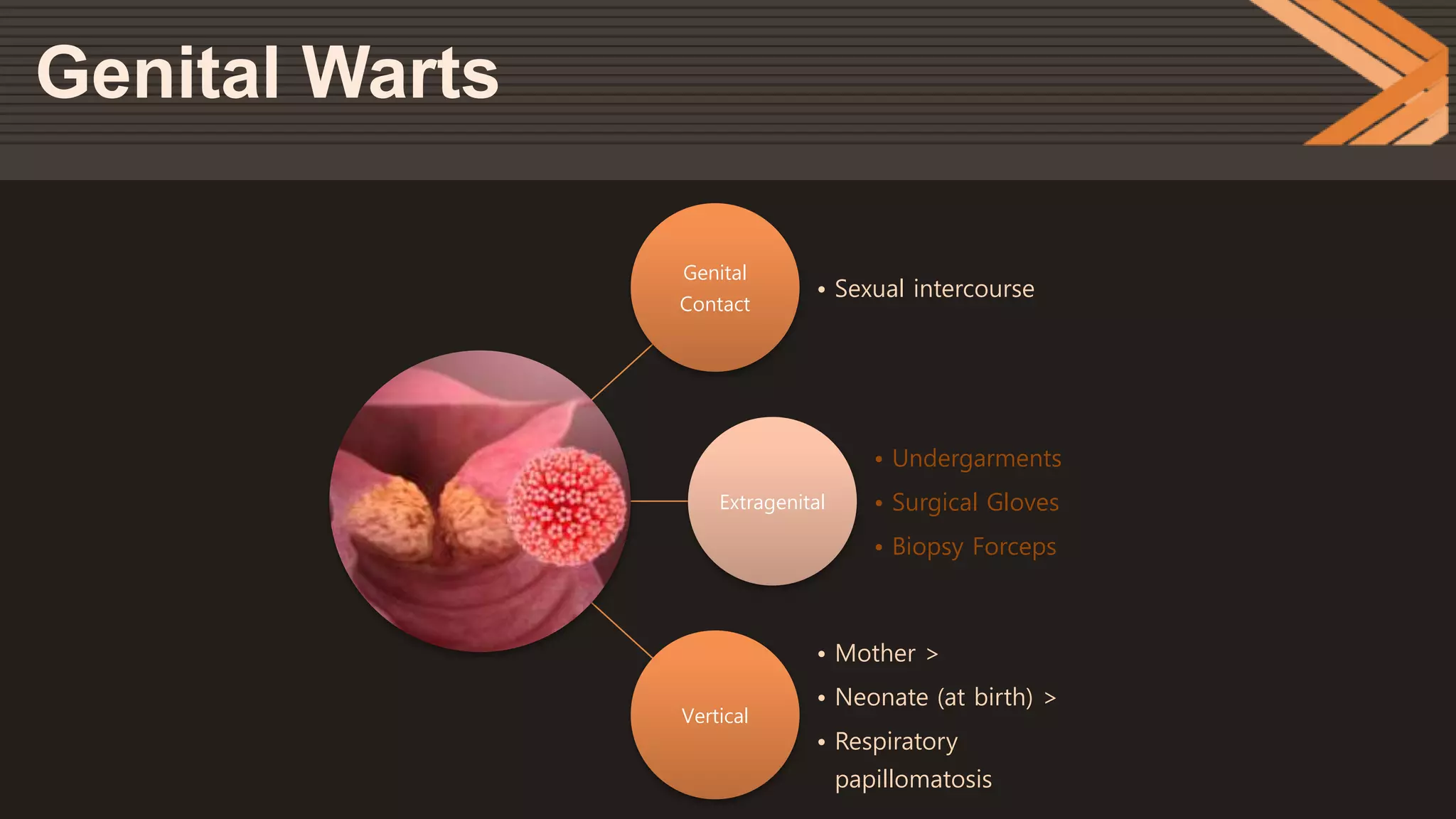 Genital Warts(HPV), Genital Herpes | PPTX