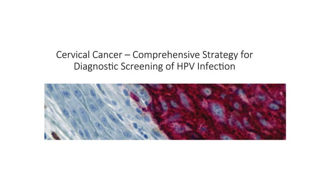 Cervical Cancer cause, epidemiology and diagnostic screening .ppt