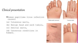 Understanding HPV: A Comprehensive Overview.pptx