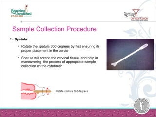 Hpv Sample Collection Procedure | PPT