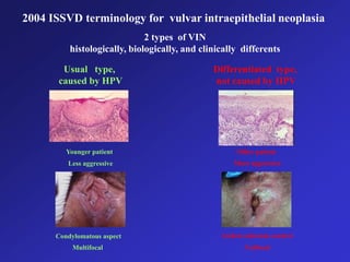 HPV VACCINATION.pptx