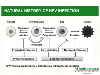 hpvvaccination7-200307083850 2.pdf