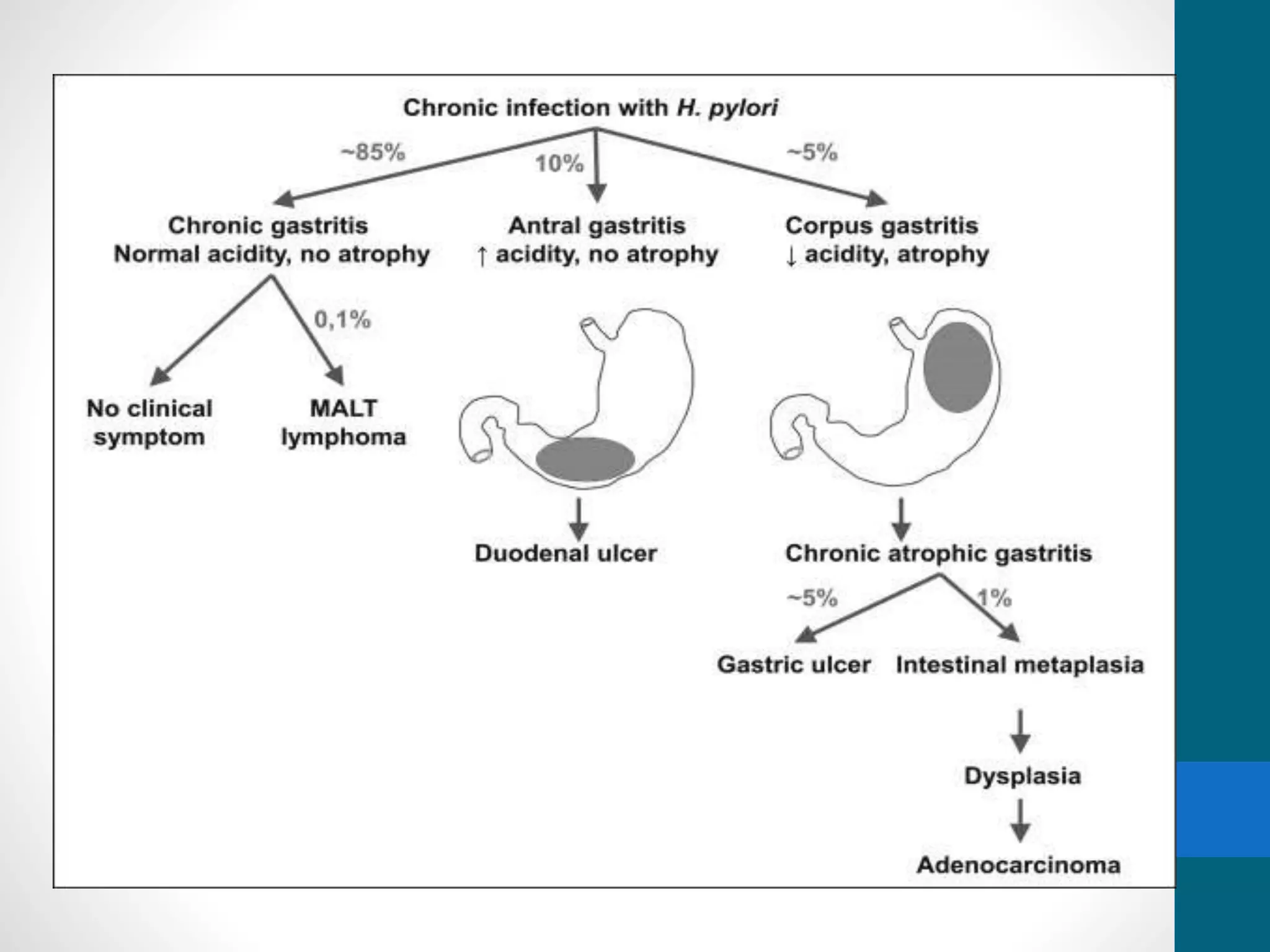 Helicobacter pylori infections | PPTX