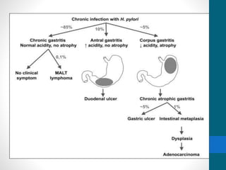 Helicobacter pylori infections | PPTX