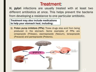 H pylori 2.pdf