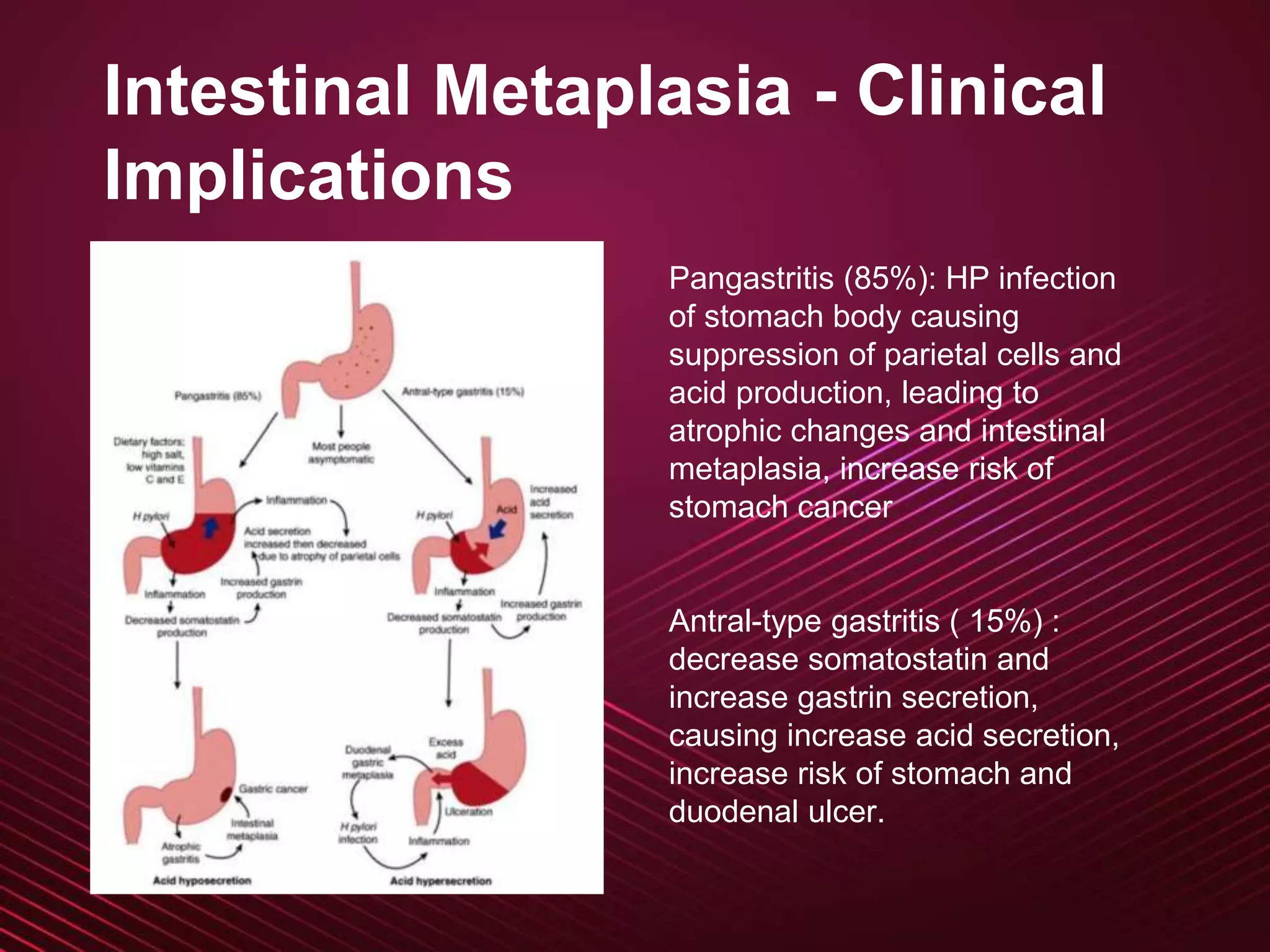 Helicobacter Pylori Infection: Management in 2020 | PPTX