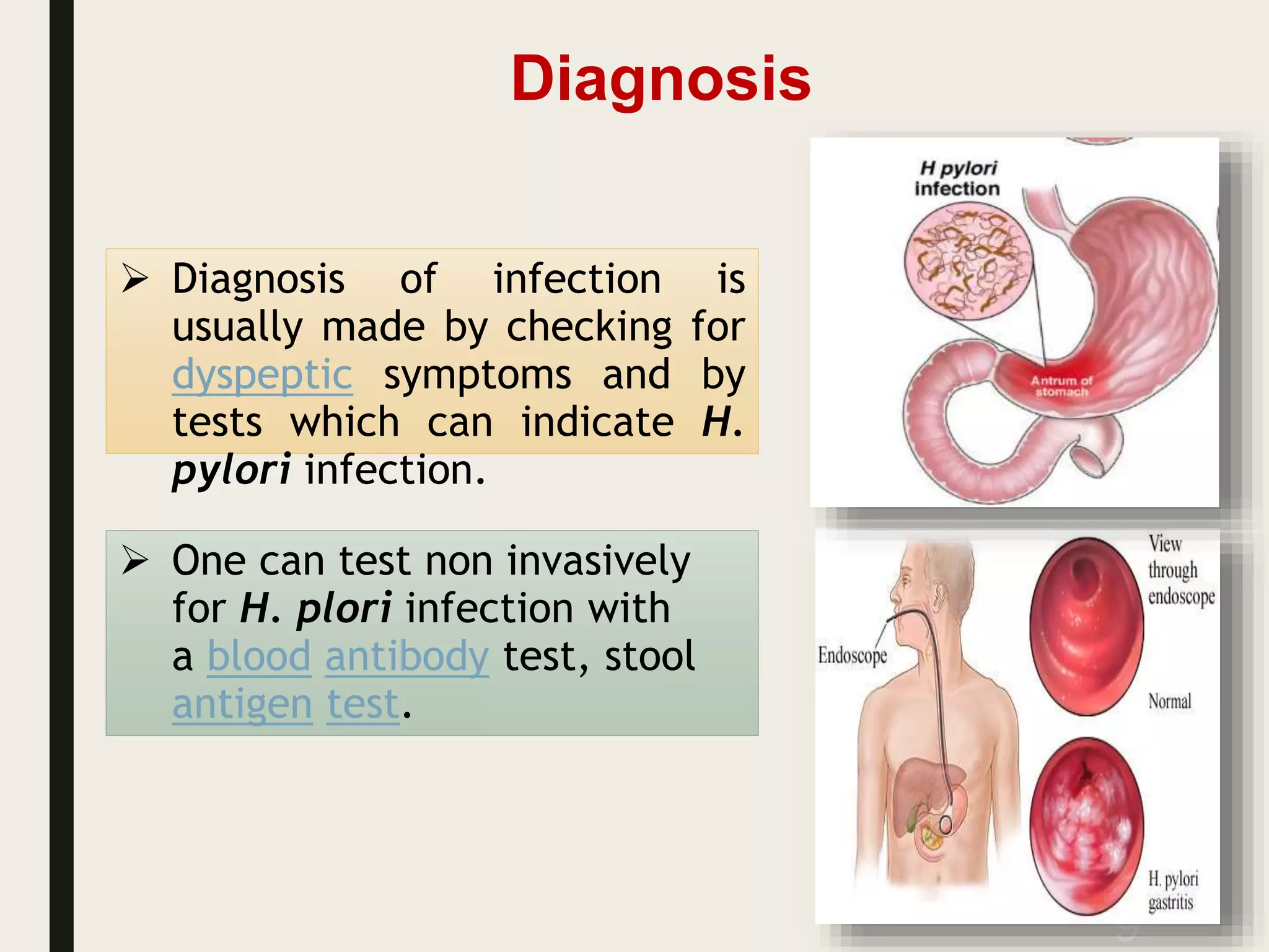 H pylori 3.pptx