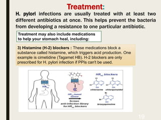 H pylori 3.pptx