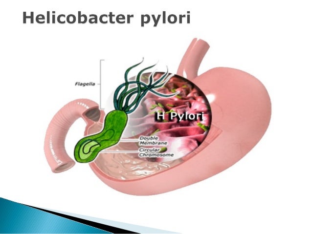 H pylori Eradication