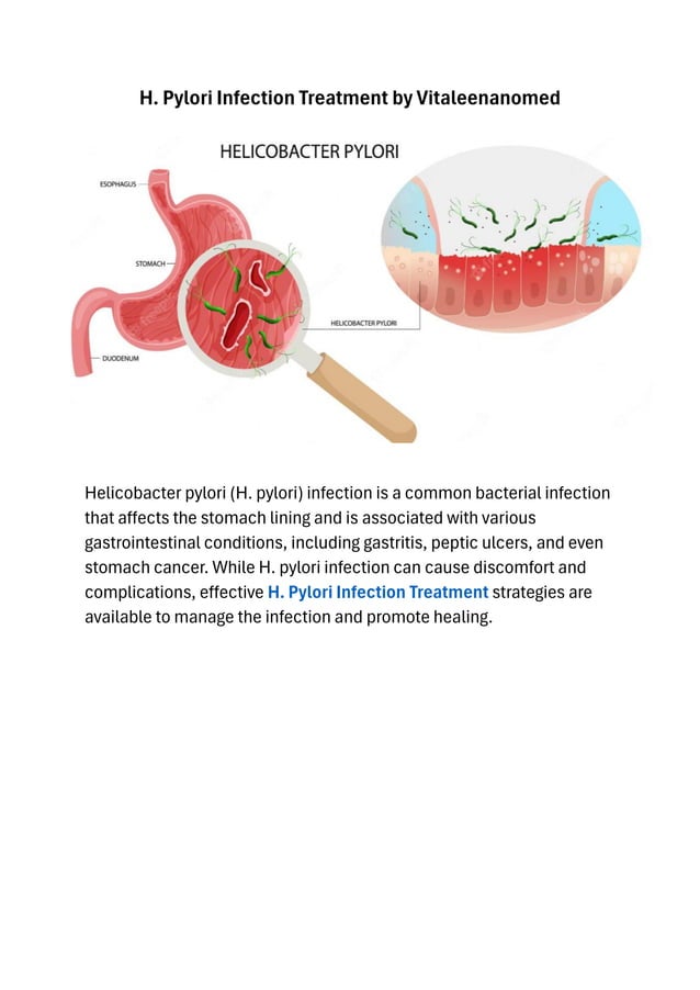 H Pylori Infection Treatment by Vitaleenanomed | PDF