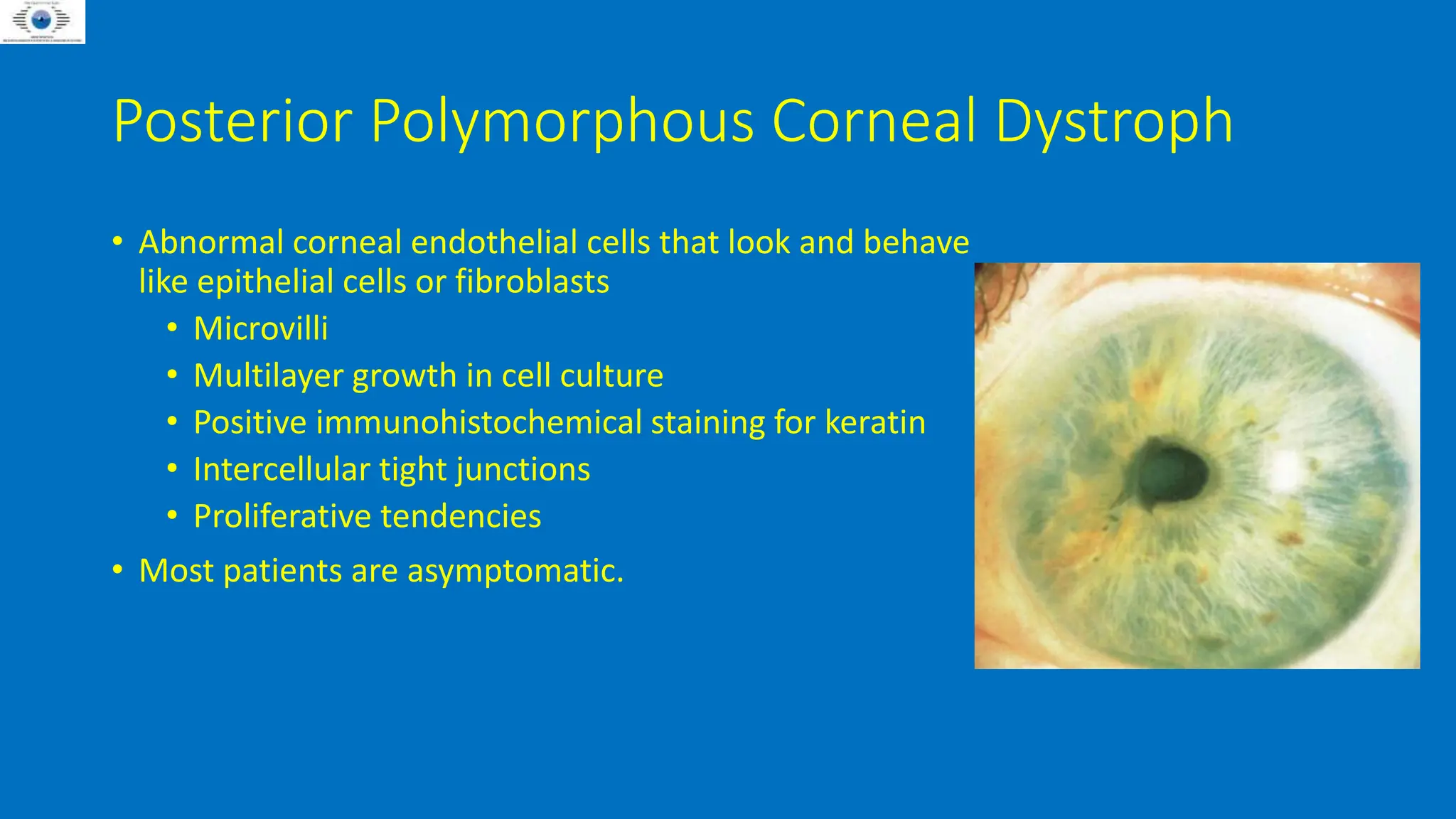 CORNEAL_DYSTROPHIES_Autosaved_DHBbwn.pptx
