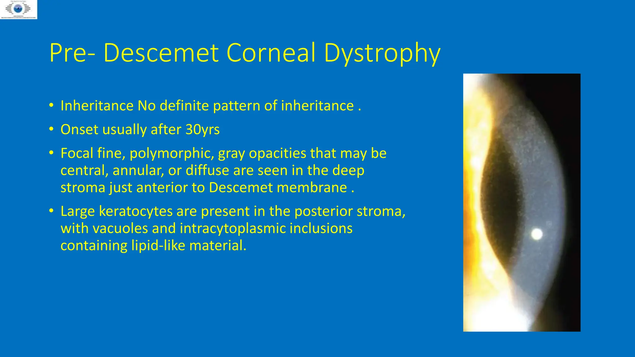 CORNEAL_DYSTROPHIES_Autosaved_DHBbwn.pptx