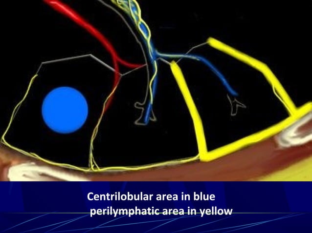 HRCT Reticular pattern | PPT