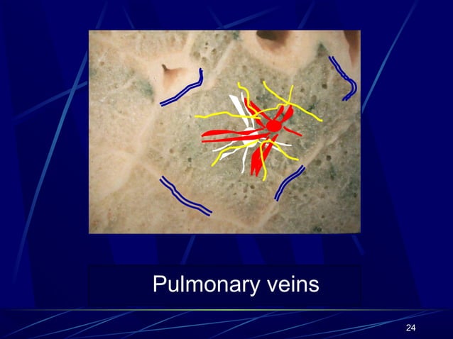 HRCT Reticular pattern | PPT