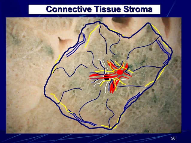 HRCT Reticular pattern | PPT
