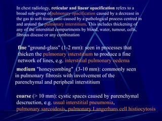 HRCT Reticular pattern | PPT