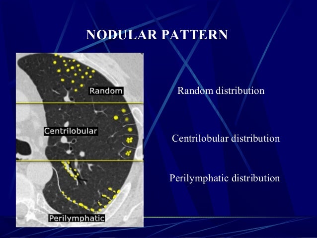 Nodularity Lung