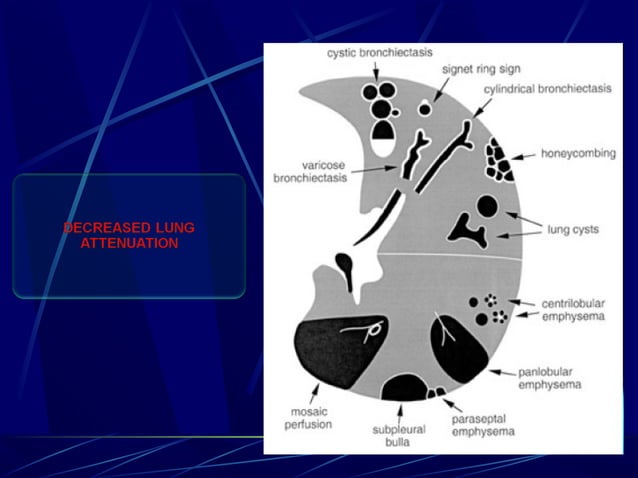 HRCT Low attenuation pattern | PPT