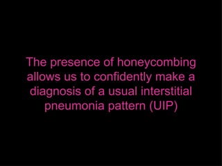 HRCT in Diffuse Lung Diseases - II (Honeycombing, UIP pattern, IPF) | PPT