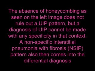HRCT in Diffuse Lung Diseases - II (Honeycombing, UIP pattern, IPF) | PPT