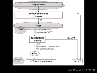 HRCT in Diffuse Lung Diseases - II (Honeycombing, UIP pattern, IPF) | PPT