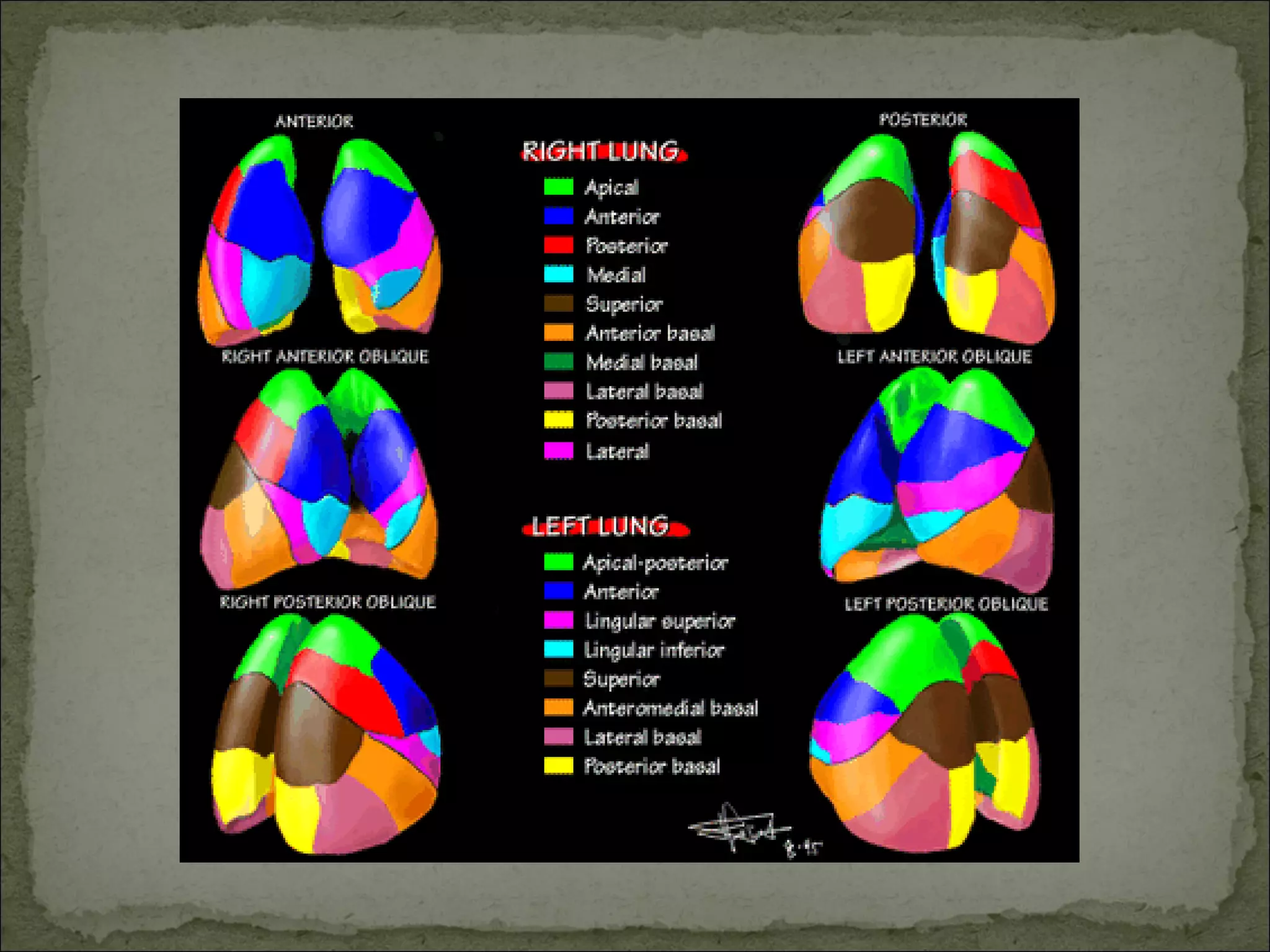 Hrct anatomy | PPT | Lung and Respiratory Health | Diseases and Conditions